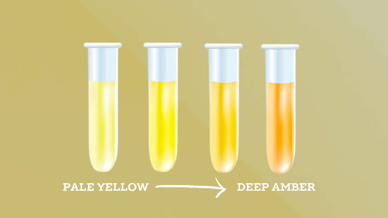 Can Taking Vitamins Change the Color of Your Urine? - Victorias Health